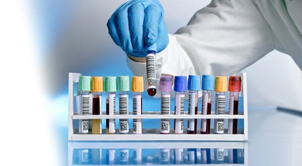 CPL Diagnostics | fastest growing lab in eastern India